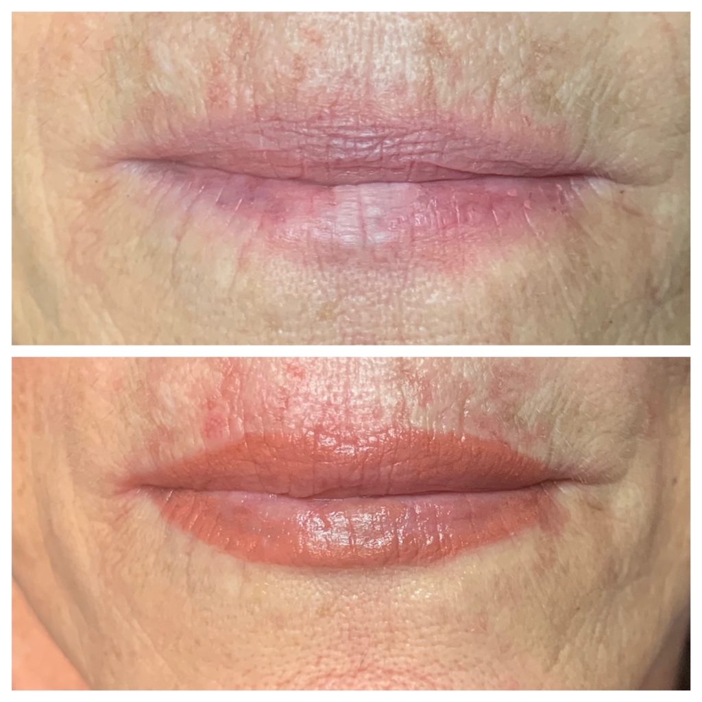 Best Permanent Lipstick, Lip LIner & Tattooed Lipstick | PermAesthetics